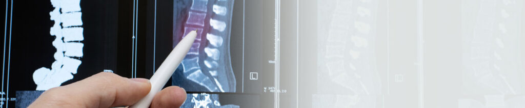 Treatments - Texas Back Institute