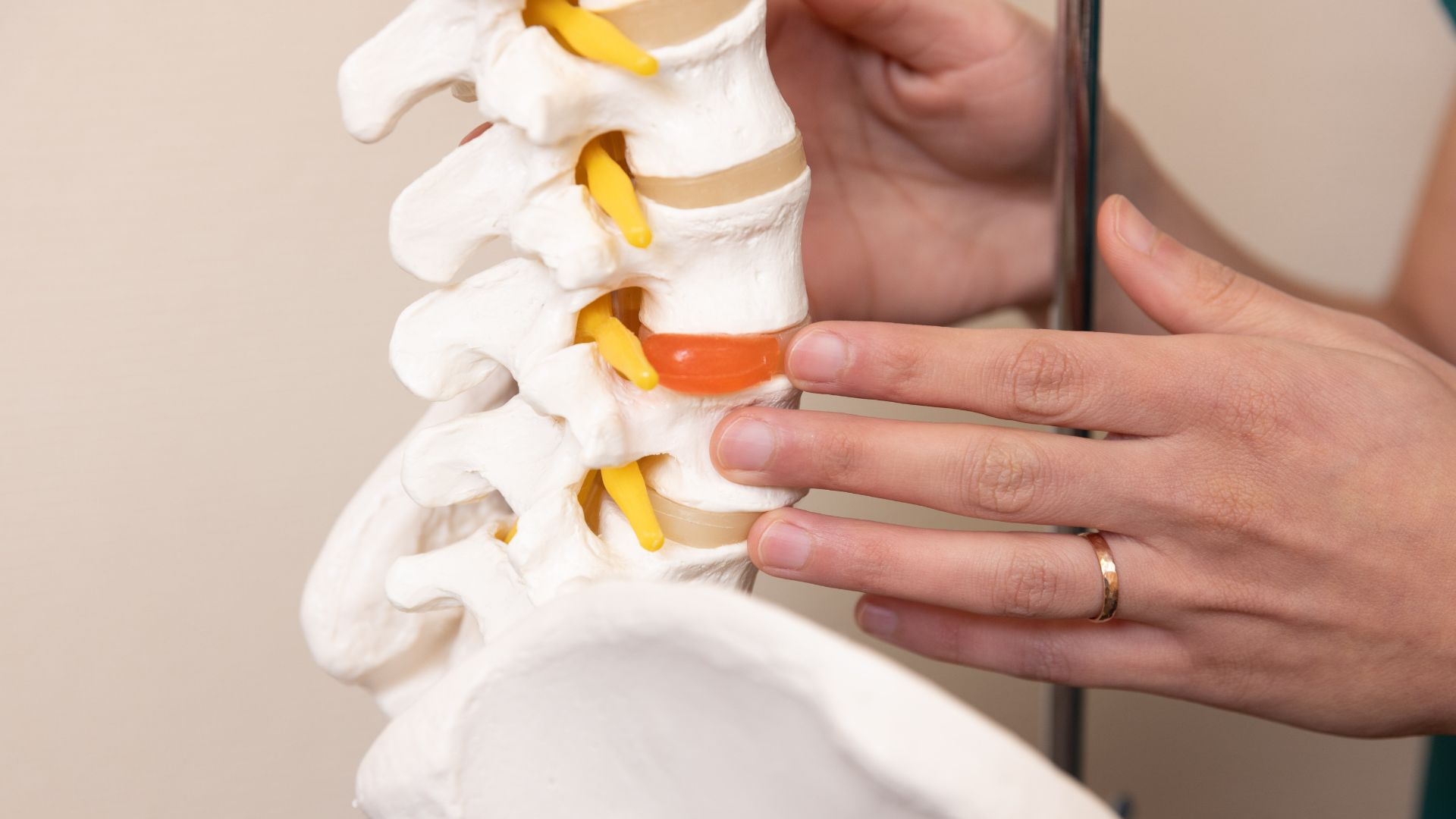 How Has Artificial Disc Replacement Evolved After 20 Years? - Texas ...